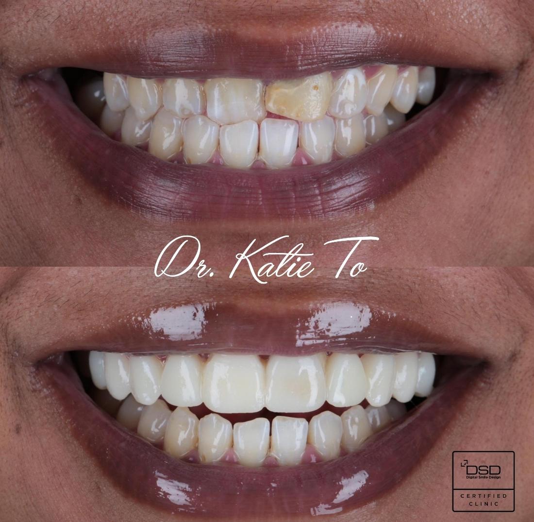 Test Drive Your Smile | Cosmetic Katy TX